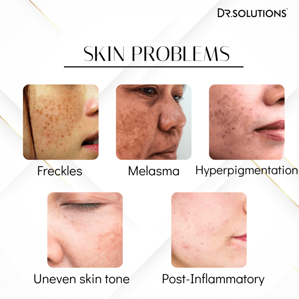 Intensive Pigment Corrector - Dr Solutions
