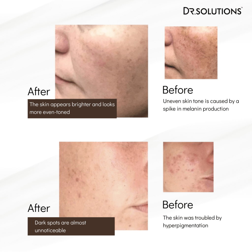 Intensive Pigment Corrector - Dr Solutions